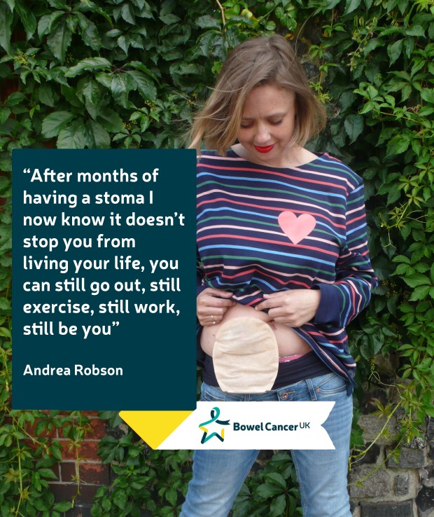 Real life stories | Personal experiences | Bowel Cancer UK