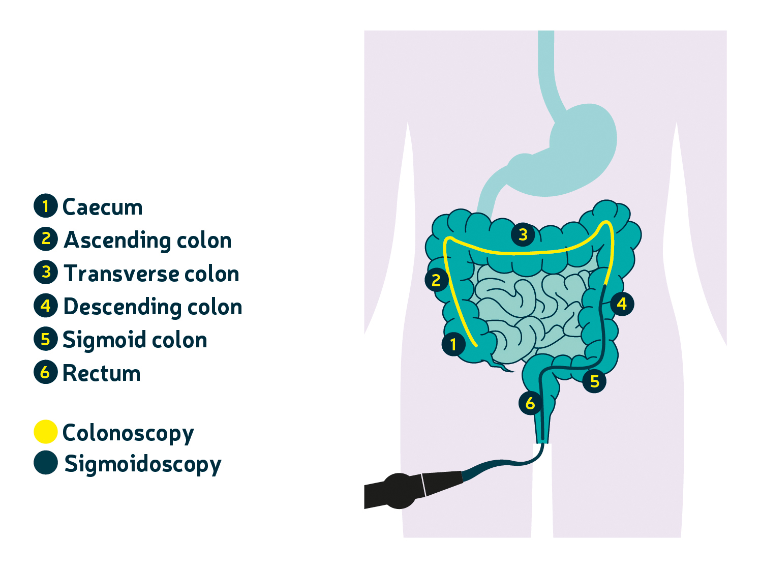 Hospital tests and colonoscopies | Bowel Cancer UK | Bowel Cancer UK